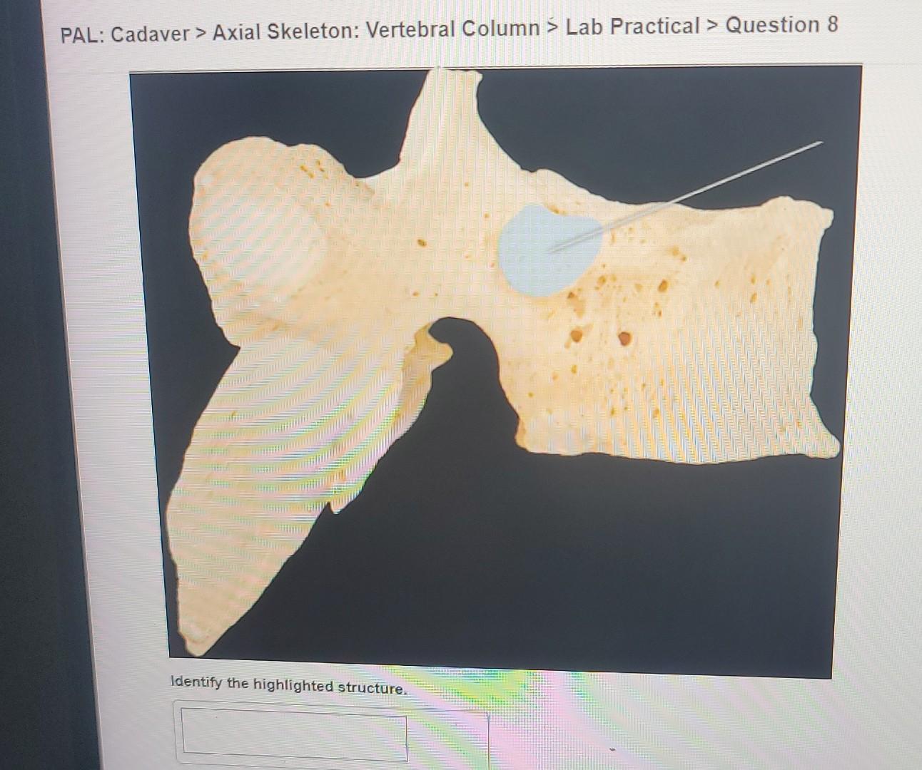 Solved PAL: Cadaver > Axial Skeleton: Vertebral Column > Lab | Chegg.com