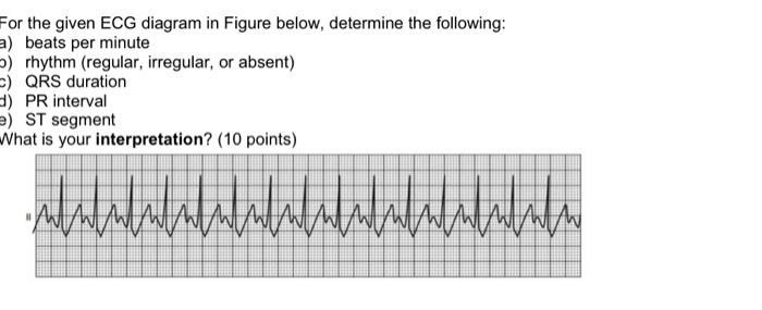 Solved For the given ECG diagram in Figure below, determine | Chegg.com