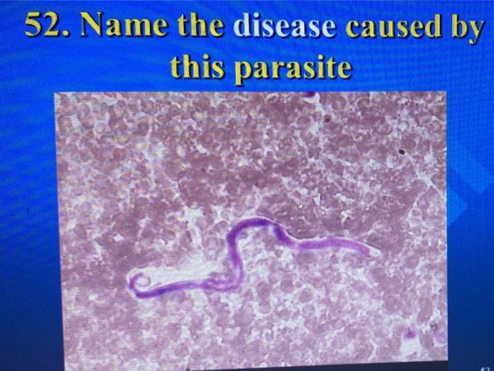 Solved 52. Name the disease caused by this parasite | Chegg.com