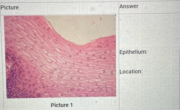 Solved Name the type of epithelium and ONE location example | Chegg.com