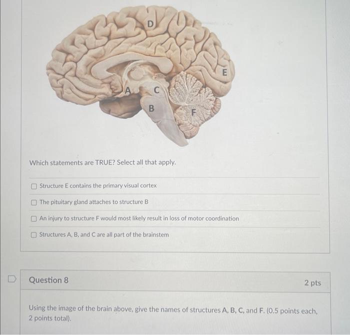 Solved Which statements are TRUE? Select all that apply. | Chegg.com