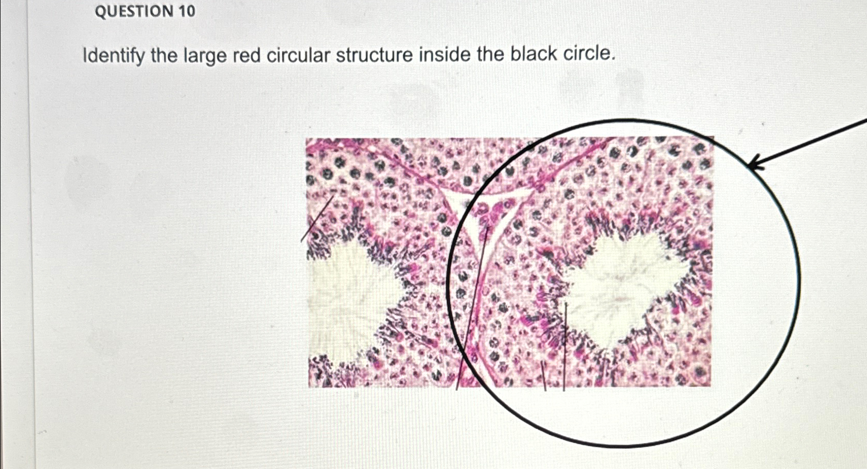 Solved QUESTION 10Identify the large red circular structure | Chegg.com