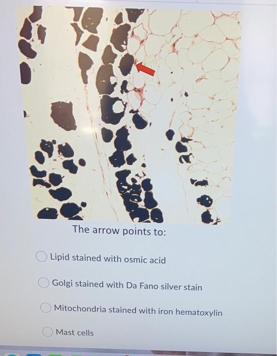 Solved What is the epithelium type? Pseudostratified | Chegg.com