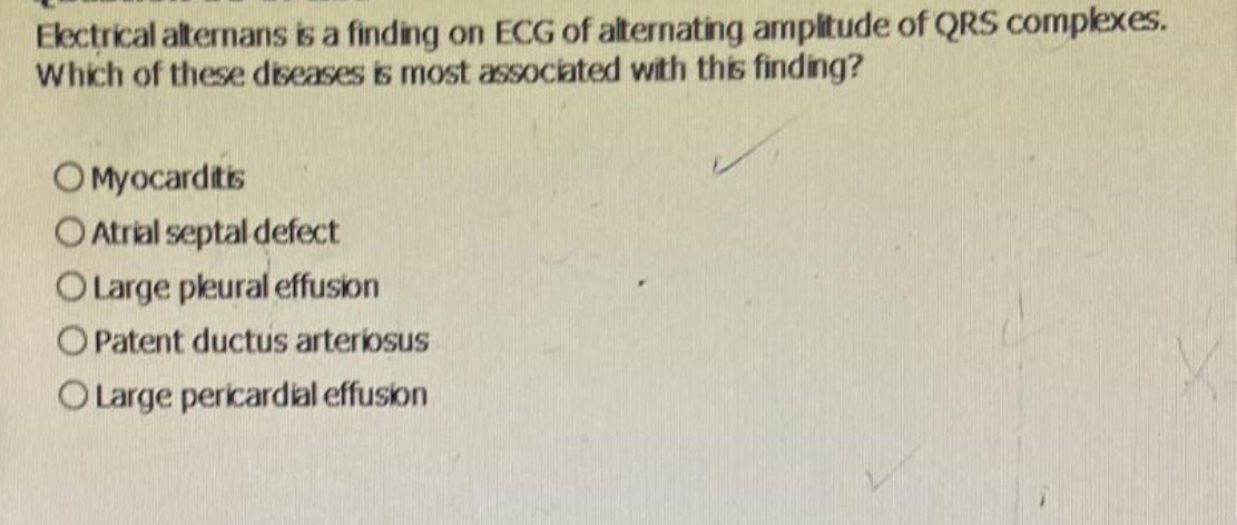 Solved Electrical alternans is a finding on ECG of | Chegg.com