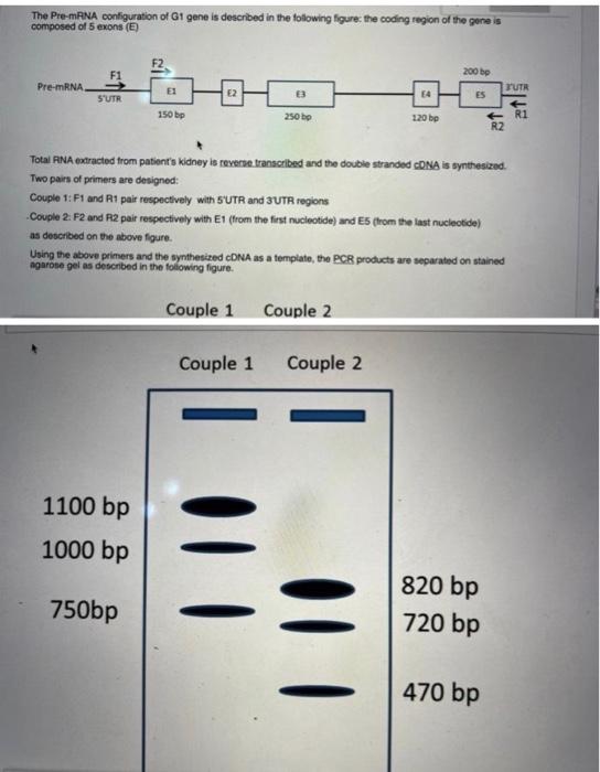 The PremRNA configuration of G1 gene is described in | Chegg.com