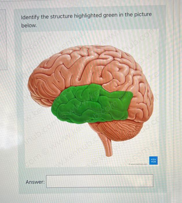 Solved Identify the structure highlighted green in the | Chegg.com