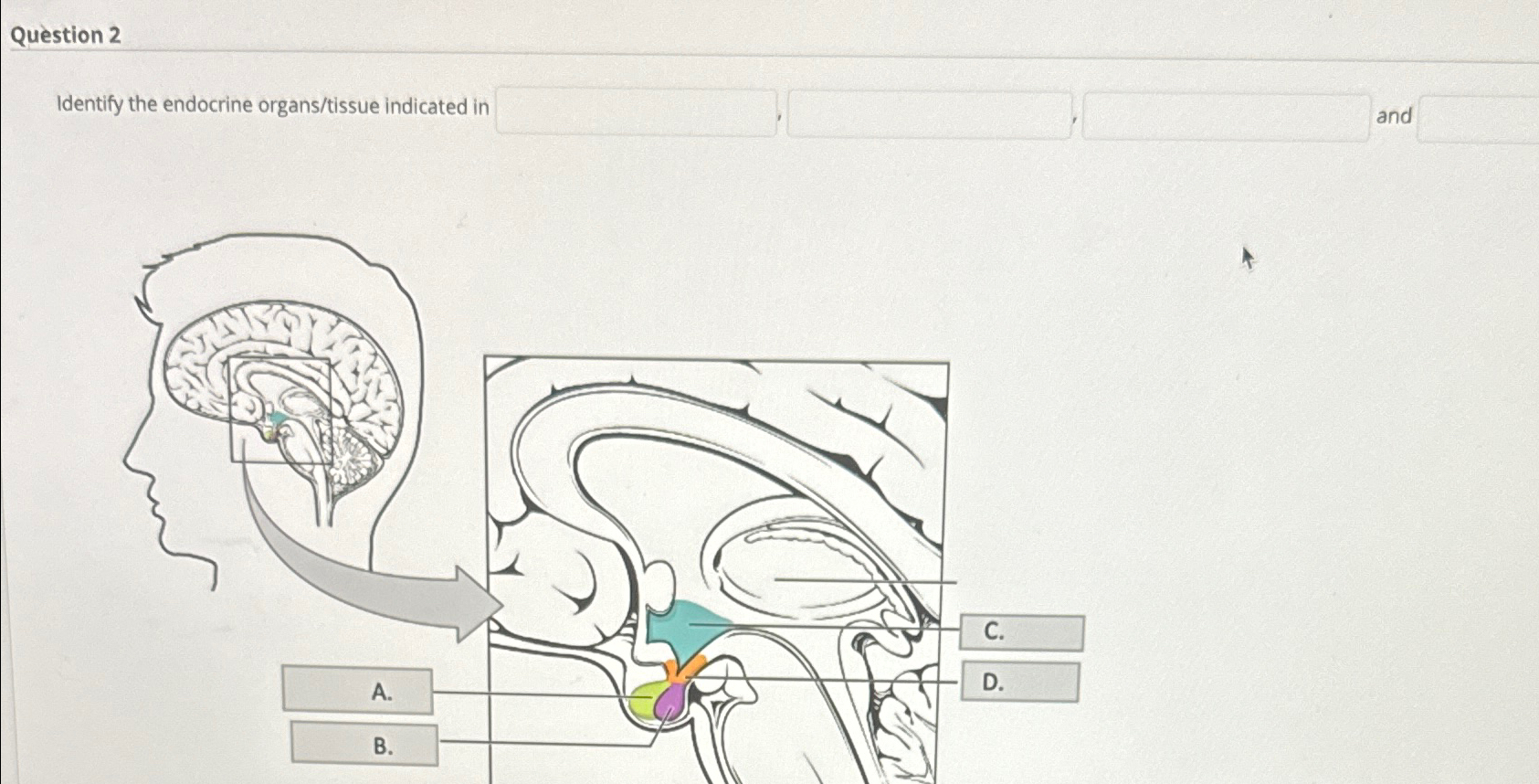 Solved Identify the endocrine organs/tissue indicated in | Chegg.com