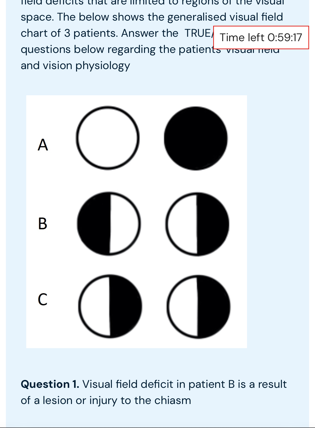 Solved Space The Below Shows The Generalised Visual Field