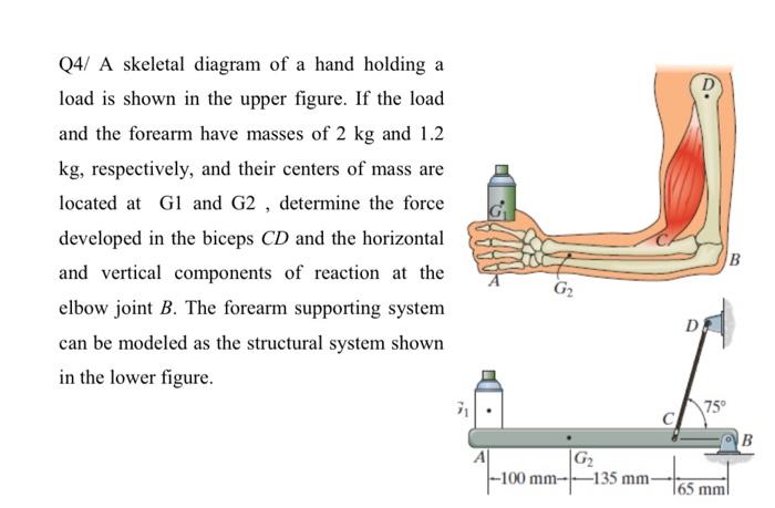 Solved Q4/ A skeletal diagram of a hand holding a load is | Chegg.com