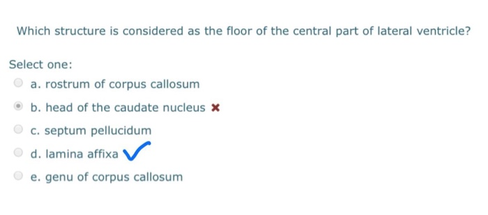 Solved Which structure is considered as the floor of the | Chegg.com
