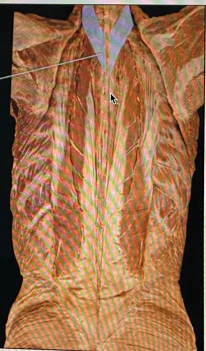 Solved Nav What is an action of the highlighted muscle? | Chegg.com