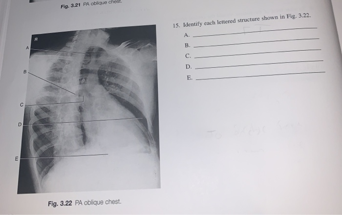 Solved E H 8. Identify each lettered structure shown in Fig. | Chegg.com