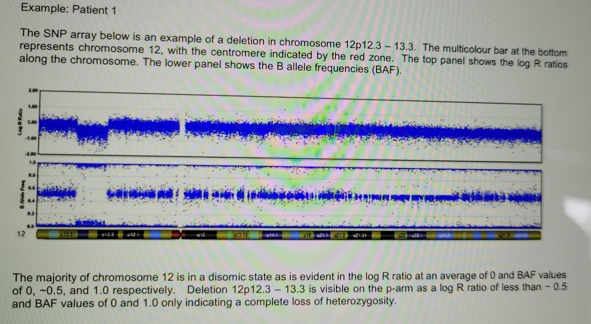 Solved Example: Patient 1 The SNP array below is an example | Chegg.com
