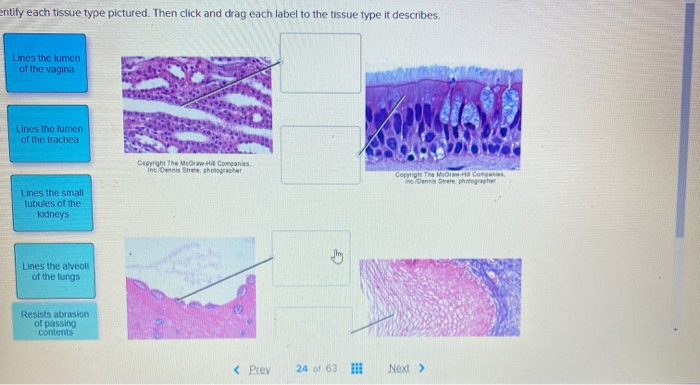 entify each tissue type pictured. Then click and drag | Chegg.com