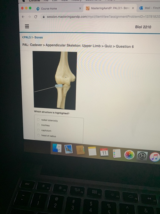 Solved: Mail- Fincher MasteringAandP: PAL3.1- Bon P Course... | Chegg.com