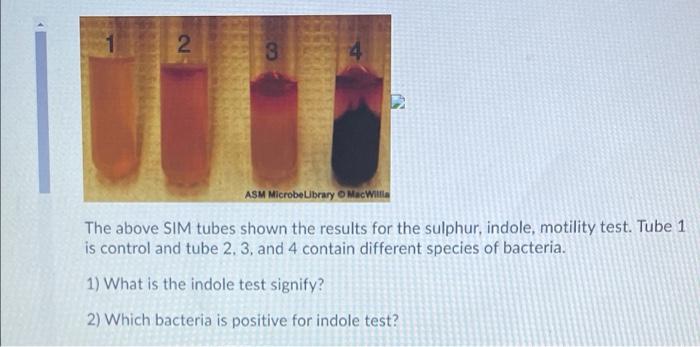 Solved 2 8 ASM Microbe Library MacWilla The above SIM tubes | Chegg.com