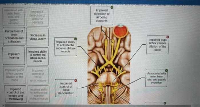 Solved MEVIOUS onsider a situation where a stroke or | Chegg.com