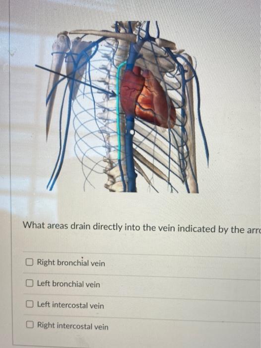 Solved What areas drain directly into the vein indicated by | Chegg.com
