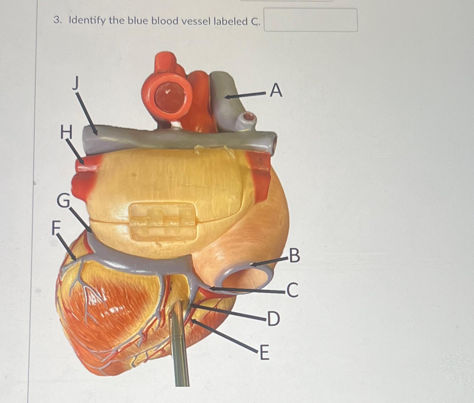 Solved Identify the blue blood vessel labeled C. | Chegg.com