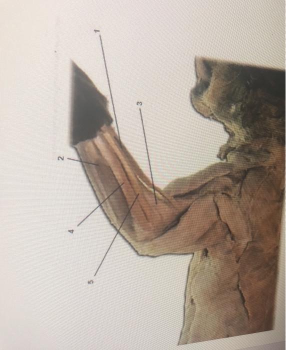 Solved Cat Muscle List Acromiotrapezius Acromiodeltoid | Chegg.com