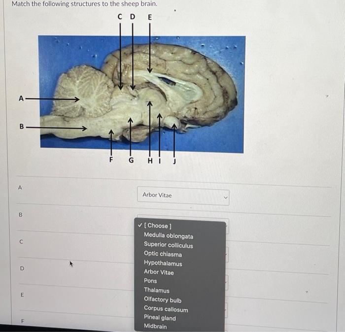 Solved Match the following structures to the sheep brain. | Chegg.com