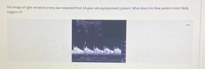 This internal carotid artery (ICA) spectral waveform | Chegg.com