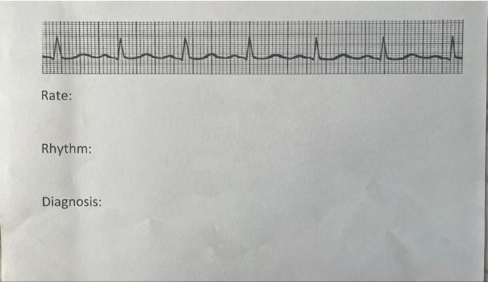 Solved Rate: Rhythm: Diagnosis: | Chegg.com