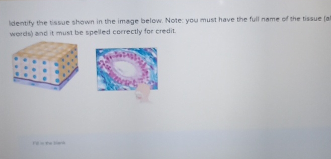 Solved Identify the tissue shown in the image below. Note: | Chegg.com