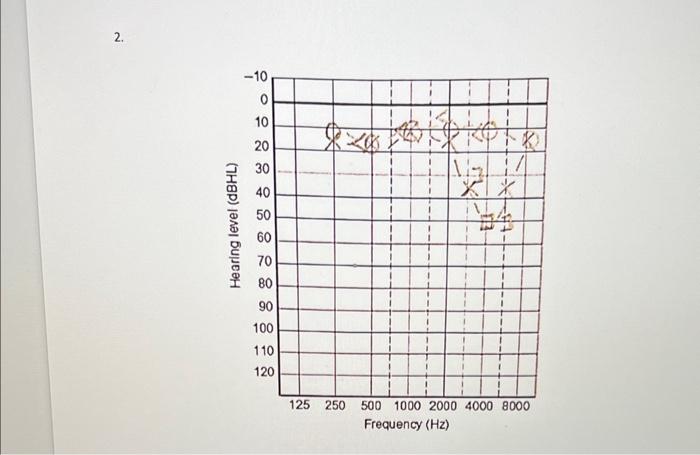 Solved Audiogram Interpretation Assignment Instructions: | Chegg.com