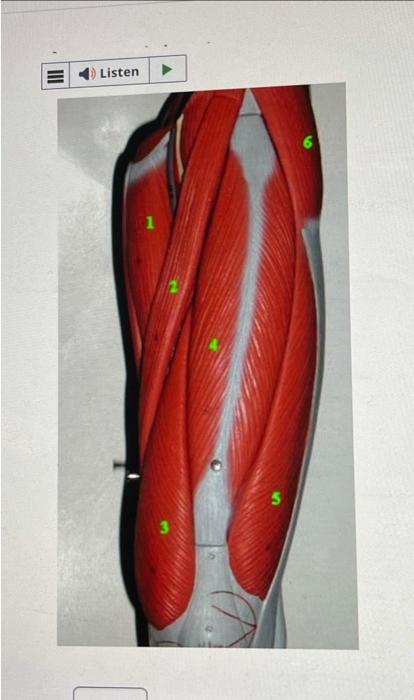 Solved Vastus Lateralis 1. Muscle Label \#1 Tensor fasciae | Chegg.com