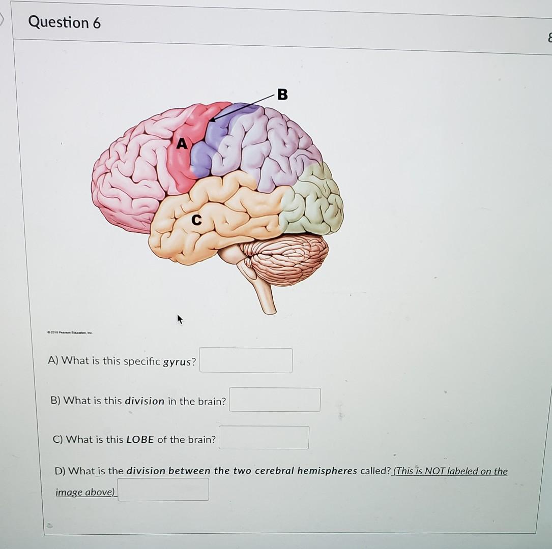 Solved Question 6 B A) What is this specific gyrus? B) What | Chegg.com