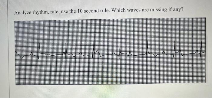 Analyze rhythm, rate, use the 10 second rule. Which | Chegg.com