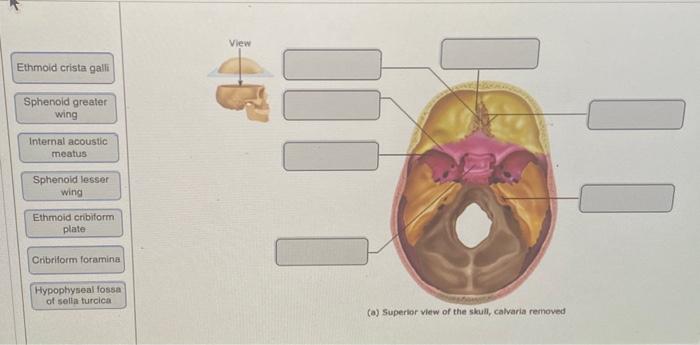 Solved (a) Superior view of the skull, calvaria removed | Chegg.com