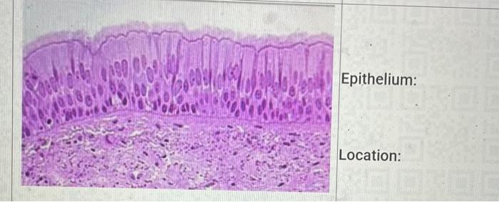 Solved Name the type of epithelium and ONE location example | Chegg.com