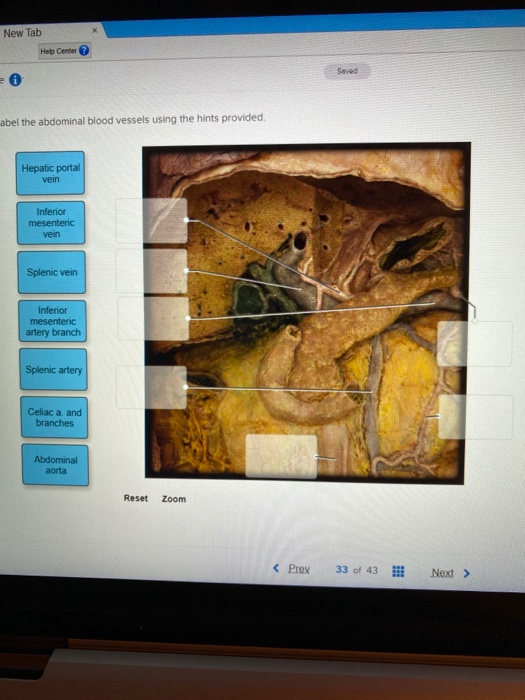 Solved New Tab Help Center? Saved abel the abdominal blood | Chegg.com