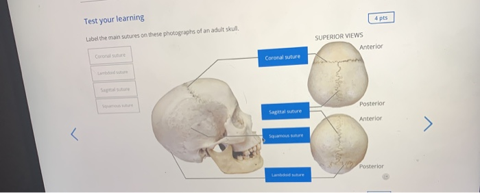 Solved 4 pts Test your learning Label the main sutures on | Chegg.com