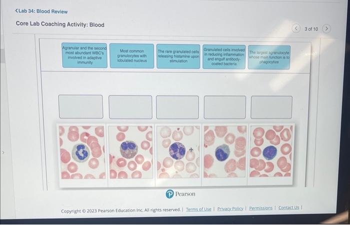 Solved CLab 34: Blood Review Core Lab Coaching Activity: | Chegg.com Solved CLab 34: Blood Review Core Lab Coaching Activity: | Chegg.com