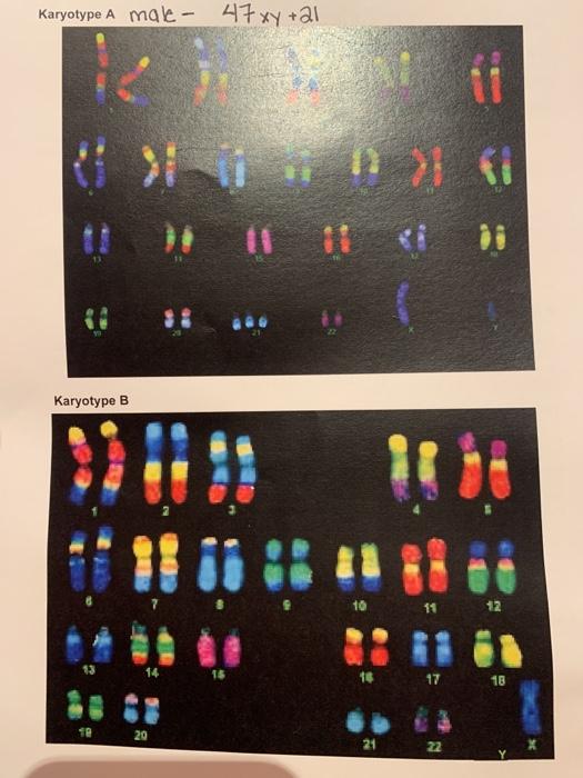 Solved ARYOTYPE ANALYSIS Karyotypes A-F are shown in the | Chegg.com