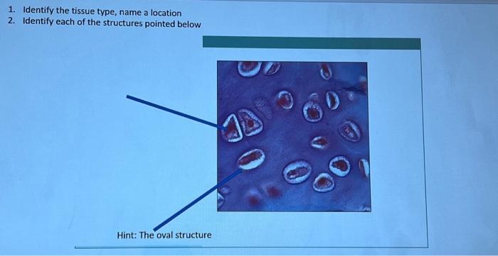 Solved 1. Identify the tissue type, name a location 2. | Chegg.com Solved 1. Identify the tissue type, name a location 2. | Chegg.com