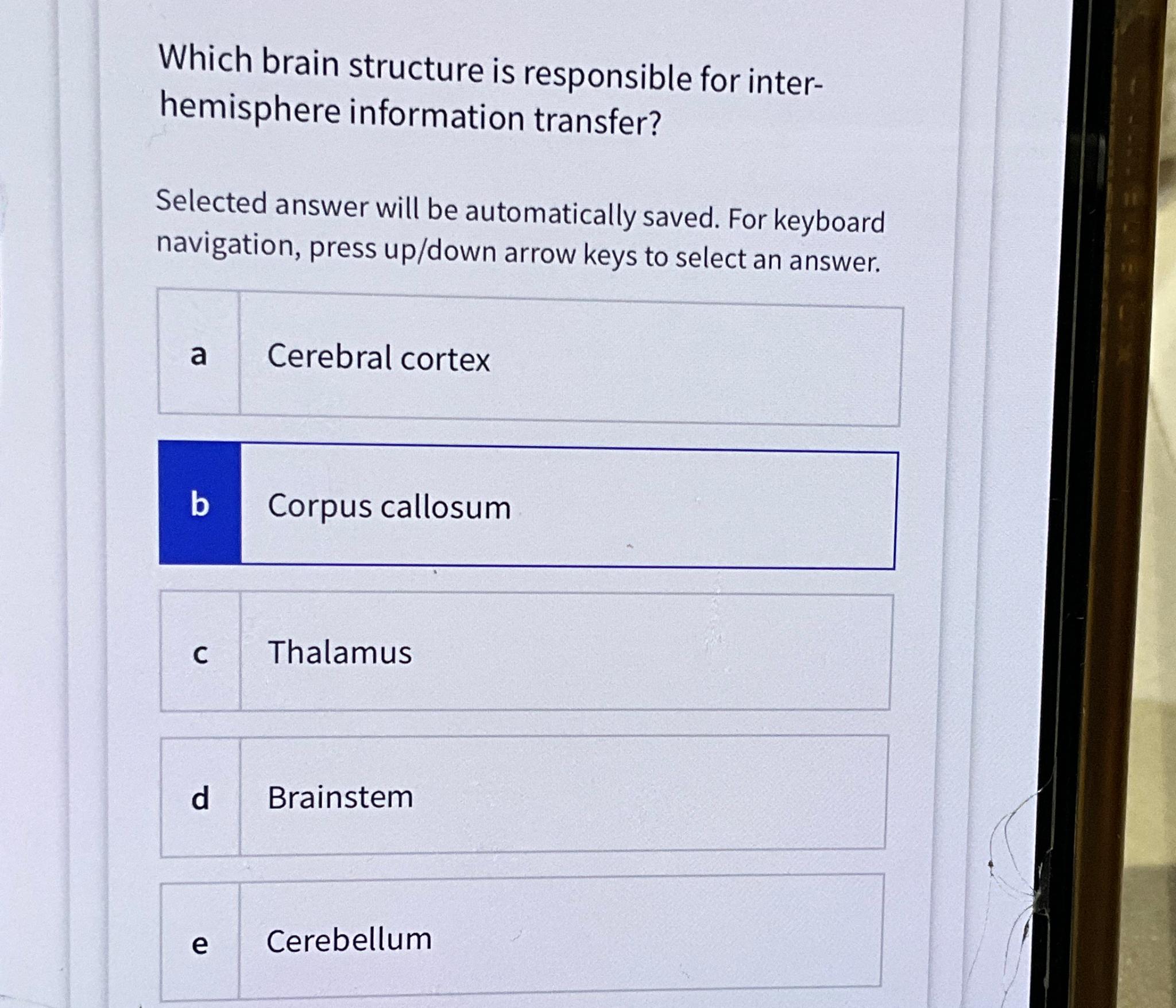 Solved Which brain structure is responsible for | Chegg.com
