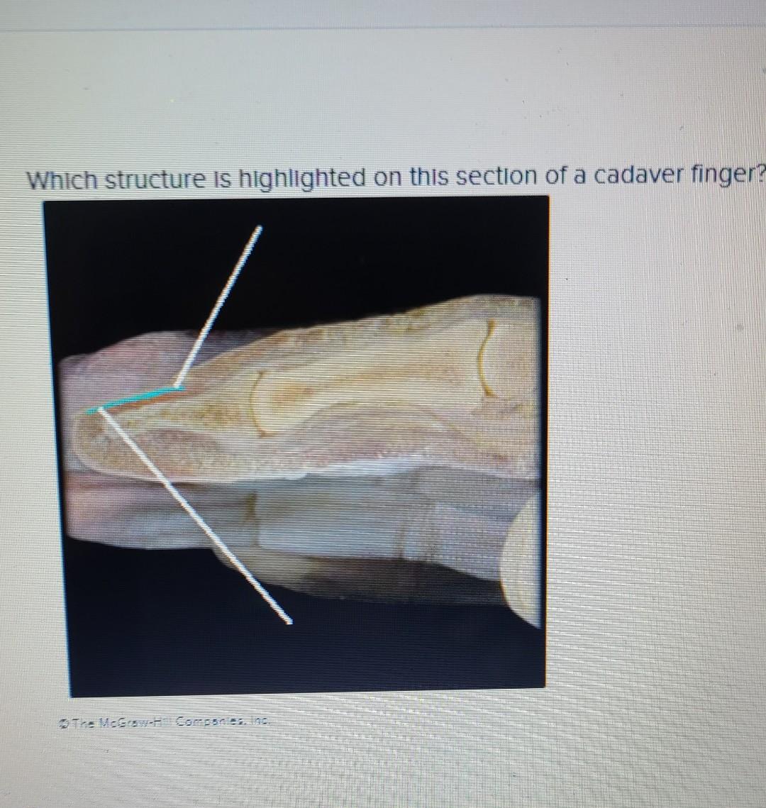 Solved Q1 with Picture 1: Which structure is highlighted in | Chegg.com