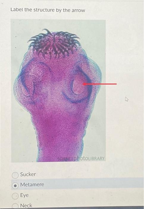 Label the structure by the arrow Sucker Metamere Eye | Chegg.com