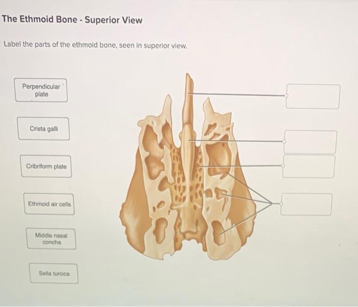 Solved The Ethmoid Bone - Superior View Label the parts of | Chegg.com