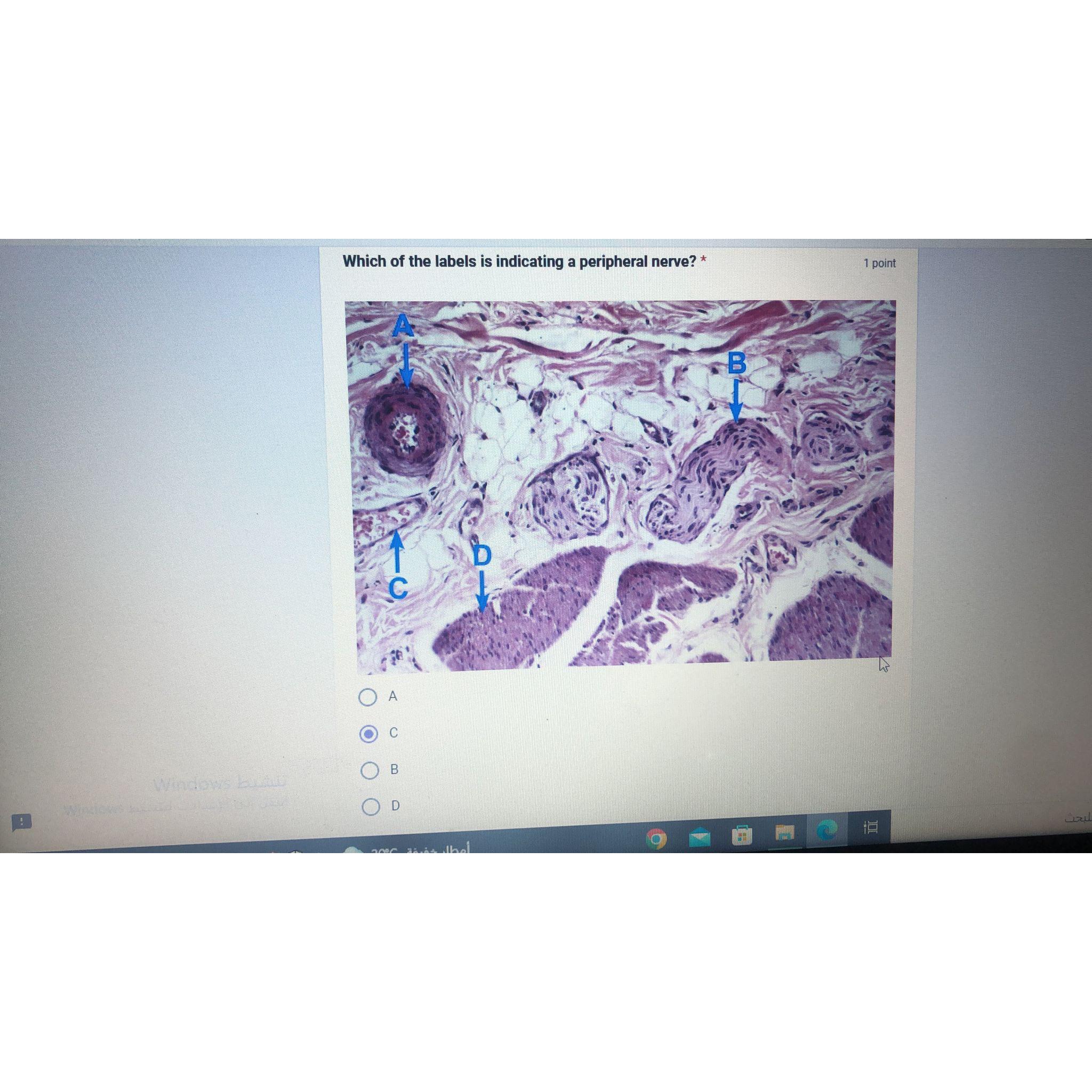 Solved Which of the labels is indicating a peripheral nerve? | Chegg.com