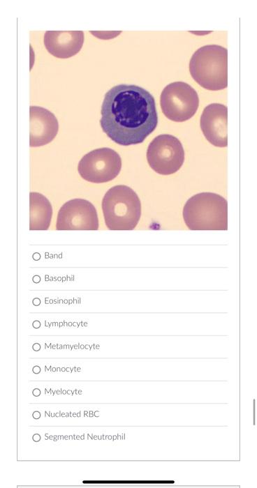Solved Band Basophil Eosinophil Lymphocyte Metamyelocyte | Chegg.com