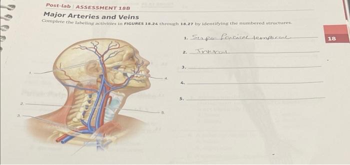 Solved Post-lab ASSESSMENT 188 Major Arteries and Veins | Chegg.com