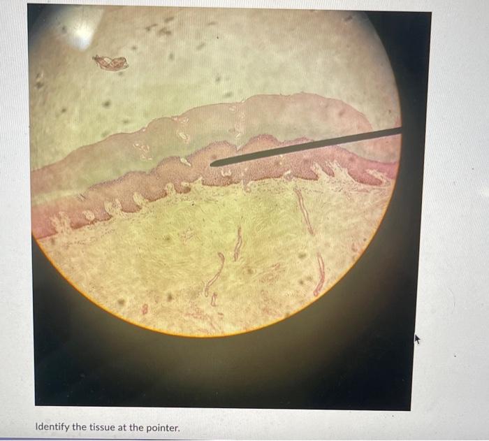 Solved Identify the tissue at the pointer. | Chegg.com
