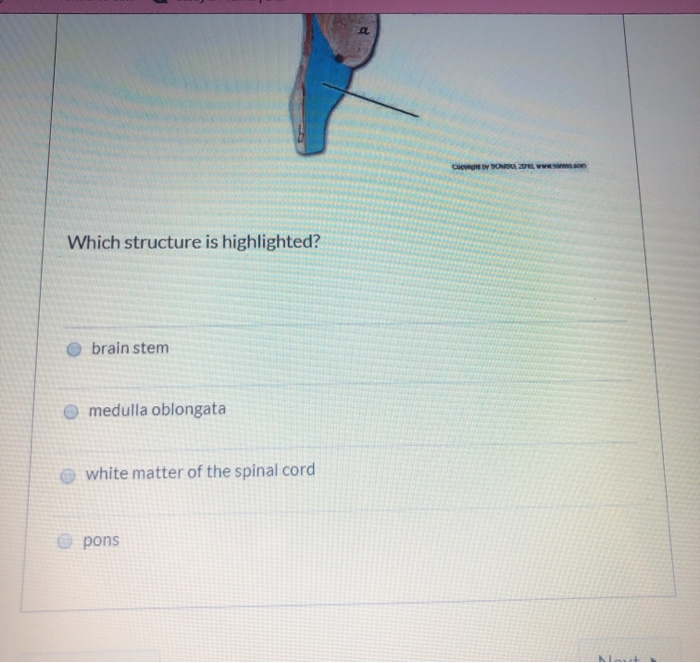 Solved Cow Which structure is highlighted? brain stem | Chegg.com