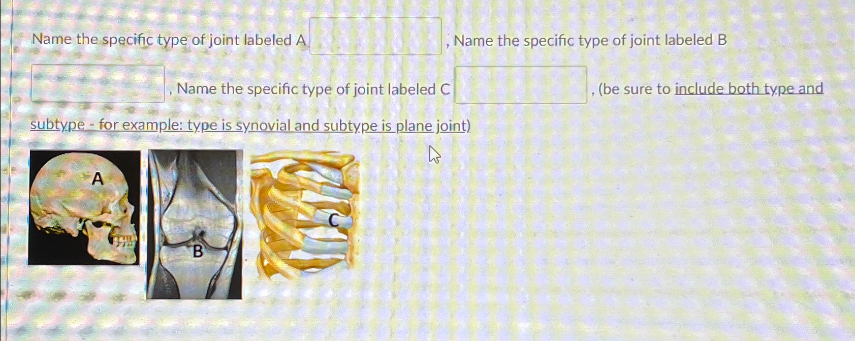 Solved Name the specific type of joint labeled A, ﻿Name the | Chegg.com