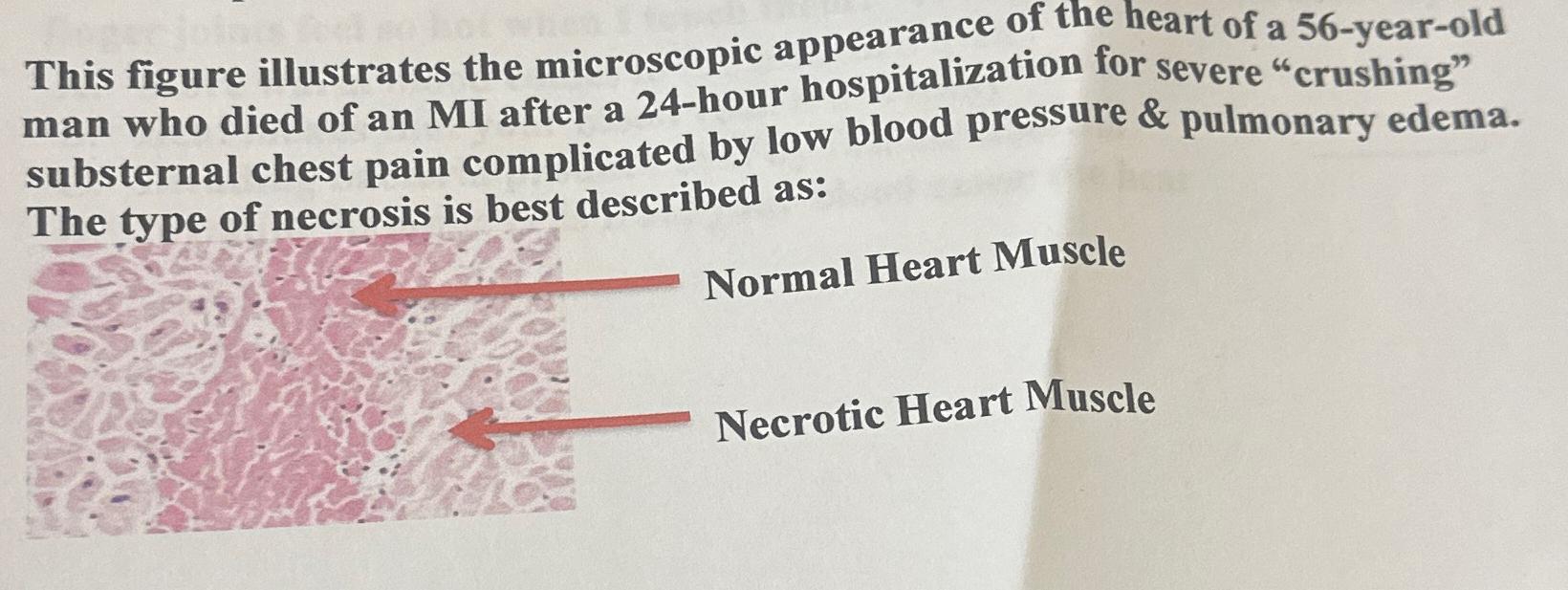 Solved This figure illustrates the microscopic appearance of | Chegg.com